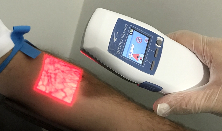 Hospital e Maternidade Unimed adquire visualizador de veias